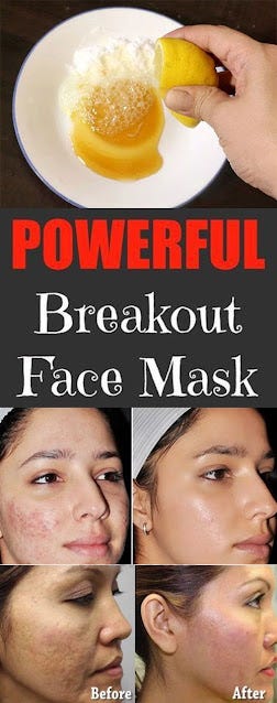 Blotches Fighting Face Mask For Acne & Blackheads - wellnessmgz4 - Medium