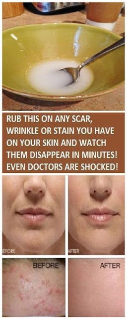 Rub This On Any Scar, Wrinkle, Or Stain On Your Skin And Watch It ...