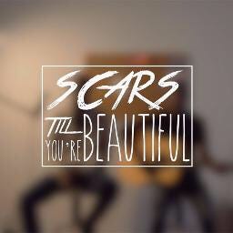 SCARS TO YOUR BEAUTIFUL. I was in third year of secondary… | by Agos ...