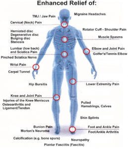 Photobiomodulation-New Technology for Controlling pain and Improving ...