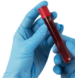Fast and Reliable Blood Tests in Chandigarh — Sanjivini Diagnostics ...