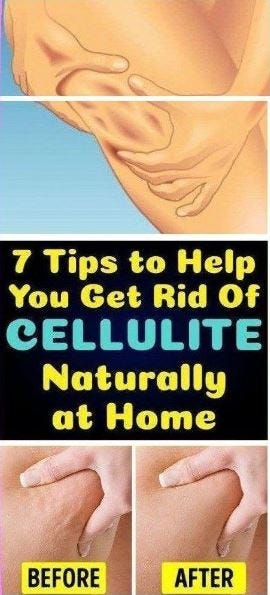 7 Tips to help you get rid of cellulite naturally at home - Linda ...