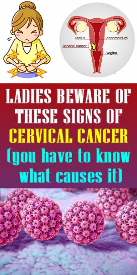 Cervical cancer — The dangers and protection from it - Nannie Welch ...