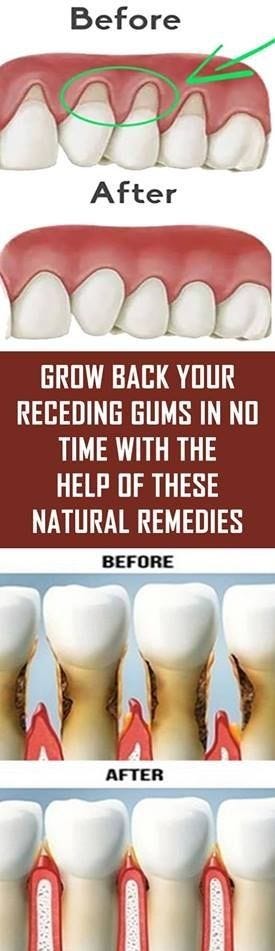 With The Help of These Natural Remedies You Will Grow Back Your ...
