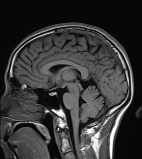 MRIs are Cool AF. Having done my graduate school in the… | by Adrian ...