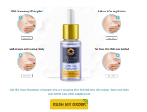 Ocean Envy Skin Tag Remover Reviews (Canada & USA, Trustworthy) Is ...