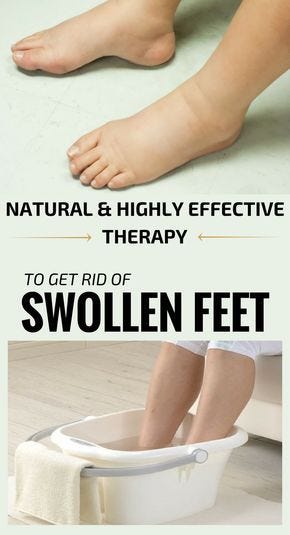 Solutions For Combating Swollen Feet With Natural Remedies - Nannie ...