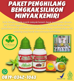 Tips menghilangkan suntik minyak kemiri tanpa operasi paling ampuh | by ...