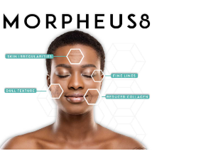 5 Reasons to Choose Complete MD for Morpheus Treatment in Mississauga ...