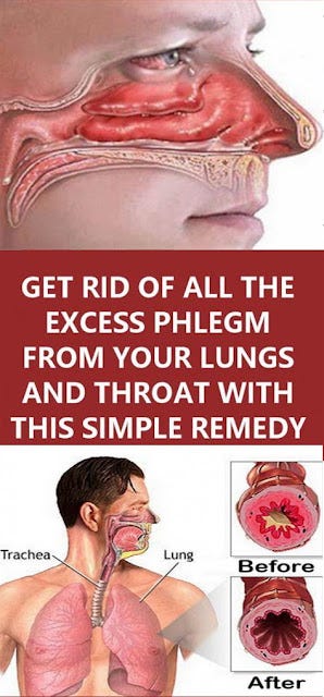 This Simple Remedy Will Get Rid Of All The Excess Phlegm From Your ...