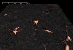 Single Cell Tracking for early Skin Cancer Detection | by C ...