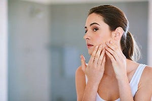 How To Get Rid Of A Pimple In An Hour | by Akash | Medium