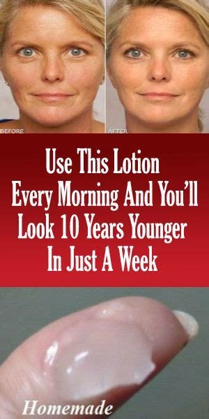 Use This Lotion Every Morning And You’ll Look 10 Years Younger In Just ...