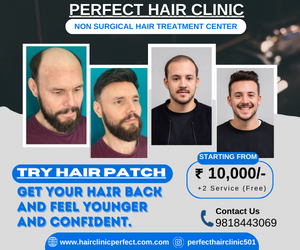 Boosting Confidence: The Transformative Power of Hair Patch Fixing | by ...