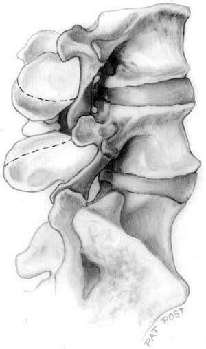 Spine. A glimpse inward, with a hat tip to… | by Gaines Post | Otherspect | Oct, 2024 | Medium