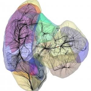 Void Dynamics: How Density Gradients Shape Our Universe | by Manuel ...