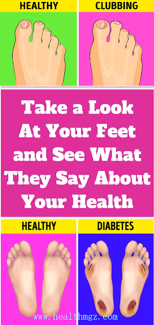 Take a Look at Your Feet and See What They Say About Your Health ...
