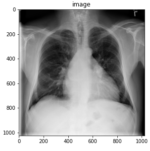 Extracting metadata from DICOM images with Python | by Nicholas Hale ...