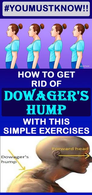 How To Get Rid Of Dowager’s Hump With This Simple Exercises | by ...