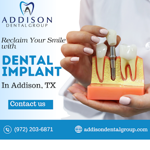 Dental Implant in Addison, TX - Addison Dental Group: Dr. Tuan Chau ...