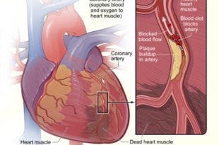 How to Lower Heart Rate. A healthy heart is the key to a long… | by ...