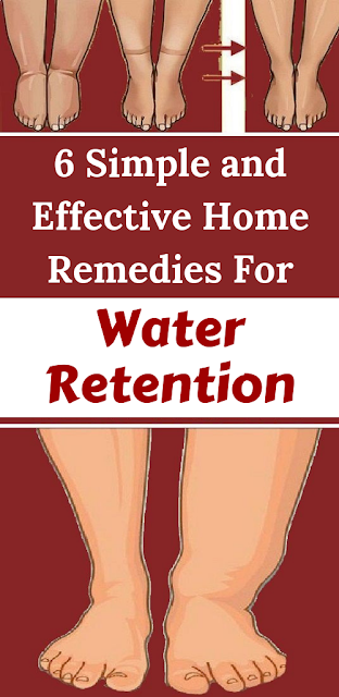 6 simple and effective home remedies for water retention - Lynn martin ...