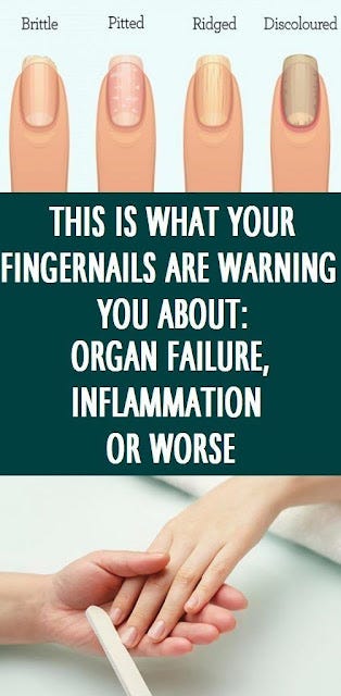 This Is What Your Fingernails Are Warning You About: Organ Failure ...
