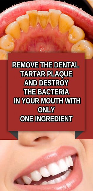 Remove The Dental Tartar Plaque And Destroy The Bacteria In Your Mouth ...