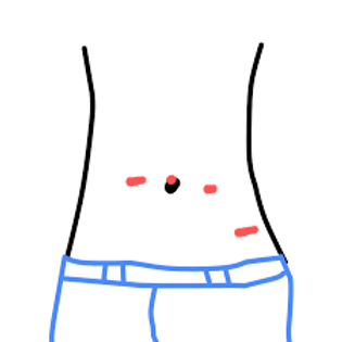 Yeeterus Part 2: Surgery. CW: surgery, gross body things | by Jonah ...