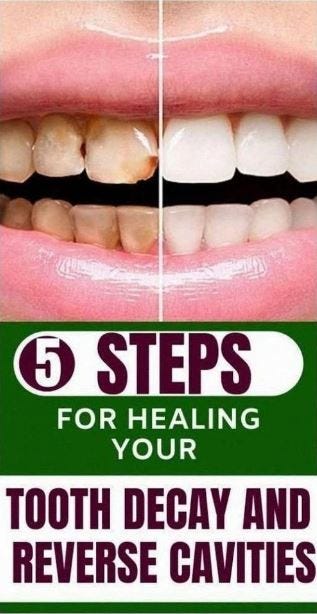 5 Steps for healing your tooth decay and reverse cavities - Linda ...