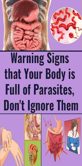 8 Symptoms of a Parasitic Infection - Mary odonnell - Medium