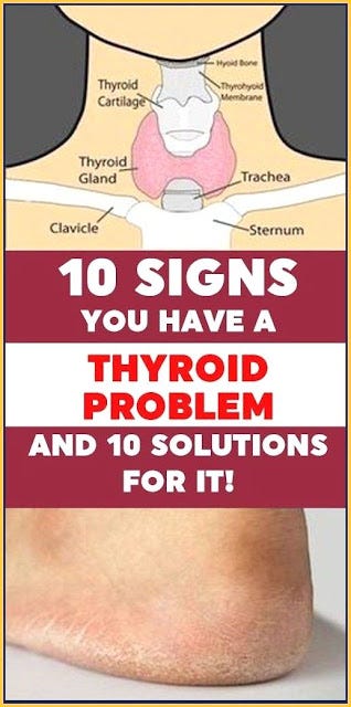 Ten Signs That Shows You Have Thyroid Problem And Solutions For It ...
