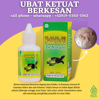 Ulasan Jenis Jerawat Bisul Ketuat Di Sekitar Kawasan Miss V Dari Biasa ...