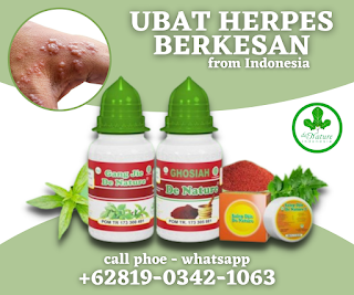 Bagaimana untuk merawat herpes ubat-ubatan dan rawatan herpes yang ...