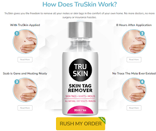 Tru Skin Fix Skin Tag Remover Reviews SECRET BEHIND Useful Skin Tag ...