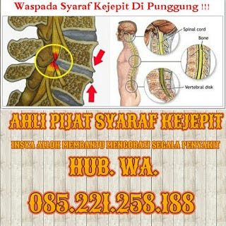 Mencegah Terjadinya Syaraf Kejepit atau Hnp dan Solusi Pengobatannya ...