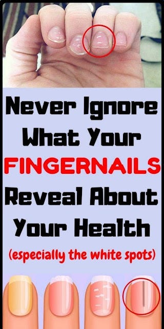 Guide To Deciphering Your Fingernail Health & What To Do About It ...