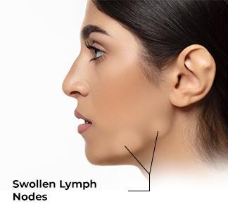 What causes Swollen Lymph Nodes | How to Treat Them | Medium