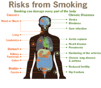 TOBACCO AND ITS EFFECTS ON HUMAN HEALTH | by Asiyaquratulain | Medium