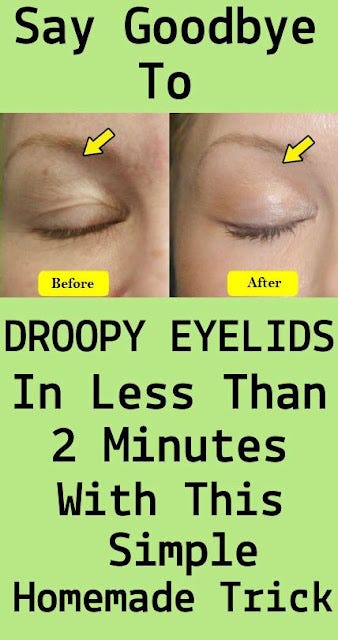 Say Goodbye To Droopy Eyelids In Less Than 2 Minutes With This Simple ...