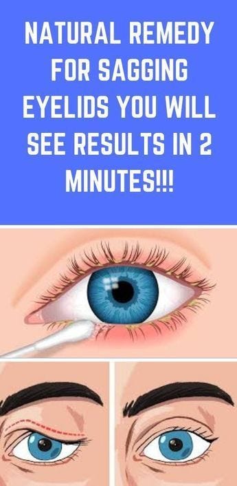 Natural Remedy for Sagging Eyelids — You Will See Results in 2 Minutes ...
