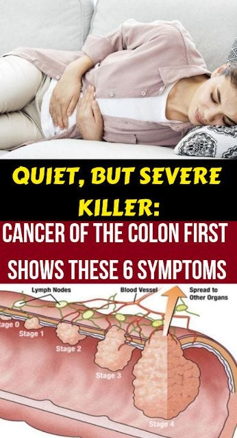 Quiet, But Severe Killer: Cancer Of The Colon First Shows These 6 ...