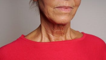 How To Lose Weight In Your Neck | by Easy Fat Loss Solutions | Medium