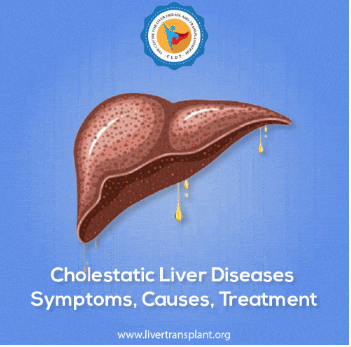 Cholestatic Liver Diseases Symptoms, Causes, Treatment — Best liver ...