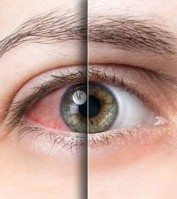 10 Early Warning Signs of Eye Diseases You Should Never Ignore | by ...