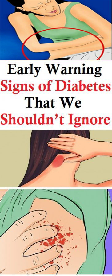 Early Warning Signs Of Diabetes You Shouldn’t Ignore - Cintia Mire - Medium