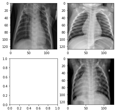 AutoKeras — Custom Image Dataset Training Using Transfer Learning ...