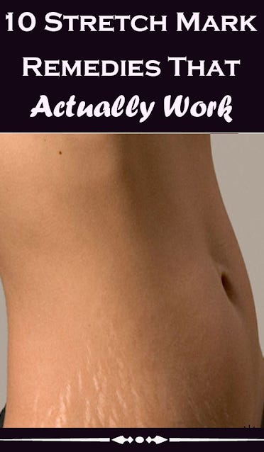 10 Stretch Mark Remedies That Actually Work - Mary odonnell - Medium