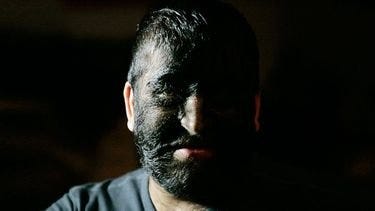 6 weird and rarest Medical conditions | by Dailyverse Original | Medium