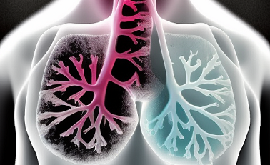 Vaping Vs Smoking: Long-Term Effects On Lungs, Positive Science? | by ...